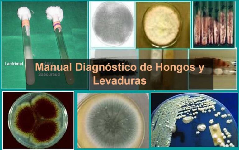 Manual Diagnóstico de Hongos y Levaduras